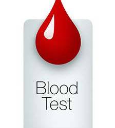 Register for SMAC blood testing by April 11